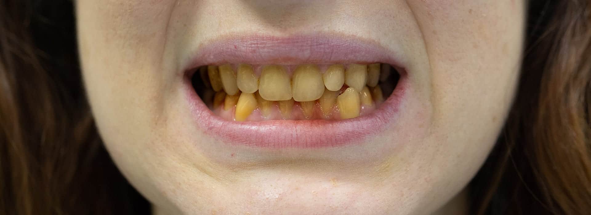 Dentista di cui ti puoi fidare Clinica dentale Smile Croazia